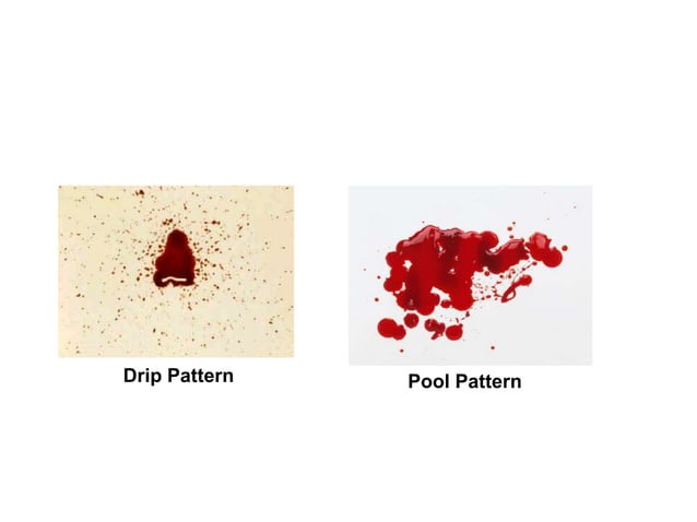 Blood stain pattern analysis | PPT | Blood Disorders | Diseases and ...