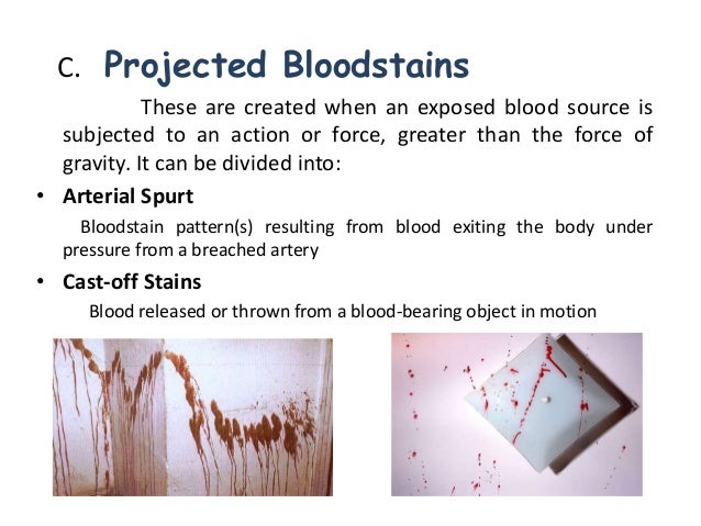 Blood stain pattern analysis
