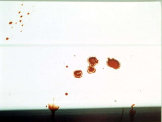 Bloodstain pattern interpretation | PPTX