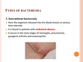 Blood stream infections- clinical microbiology | PPTX