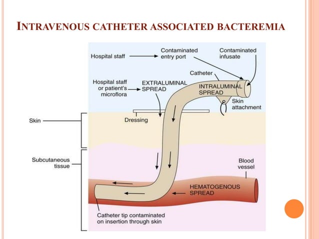 Blood stream infections- clinical microbiology | PPT