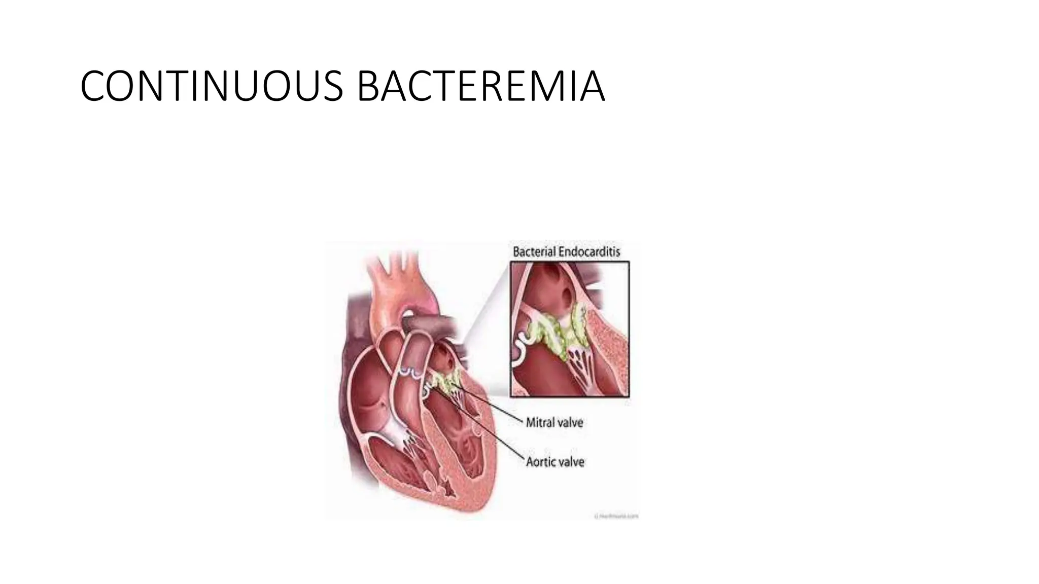 blood stream infections in microbiology CBME curriculum | PPTX
