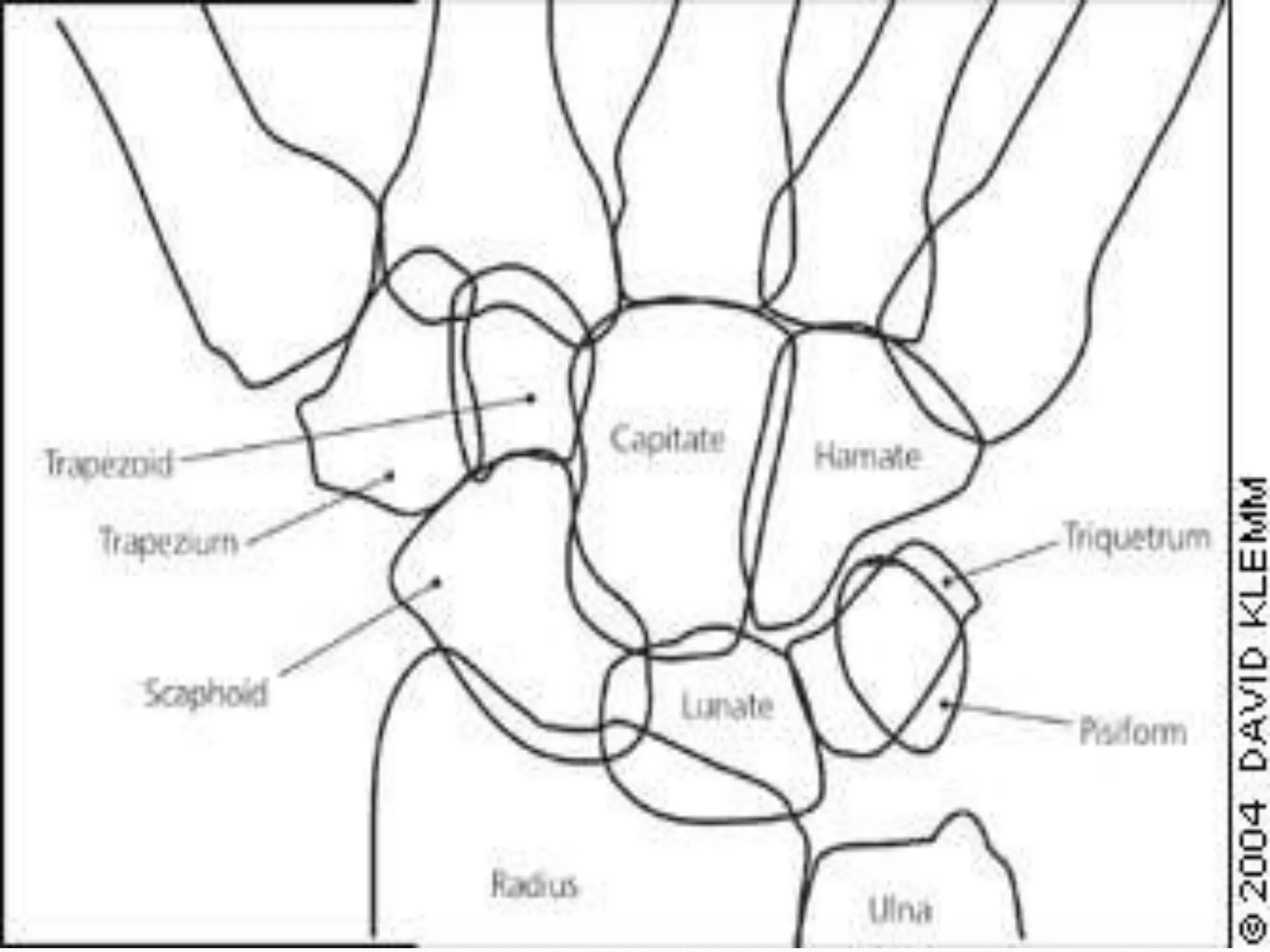 Blood supply & fractures of scaphoid | PPTX