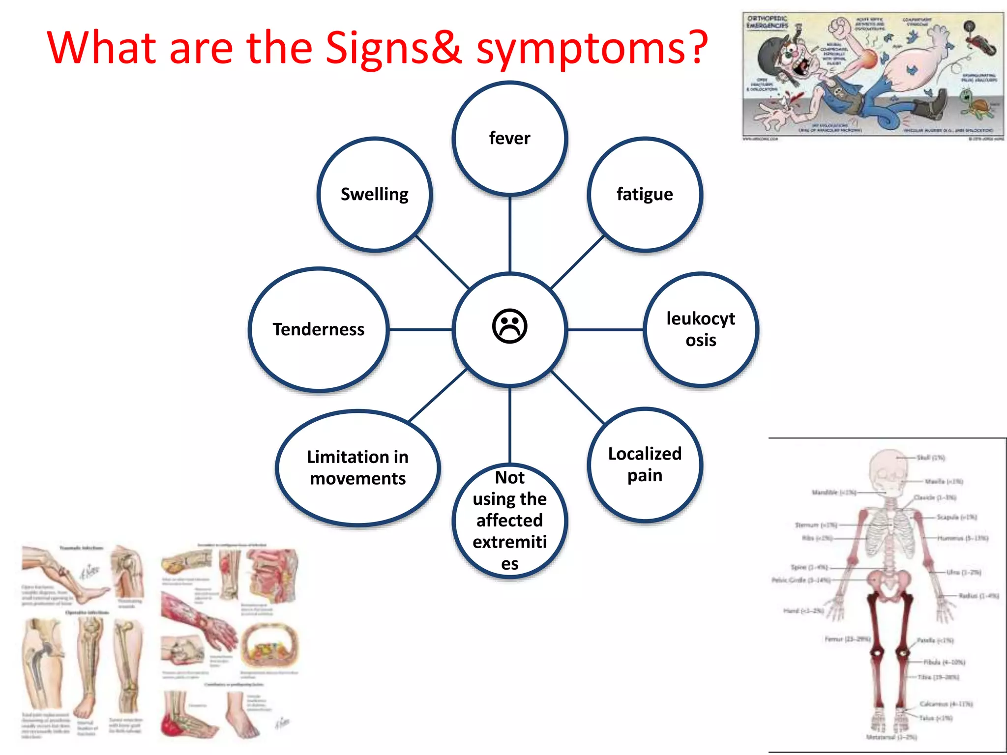 Blood supply of bone & management od osteomyelitis | PPTX | Death ...