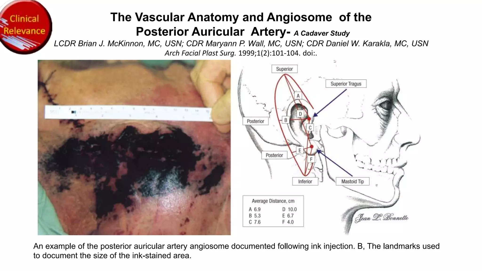 Blood supply of face | PPTX