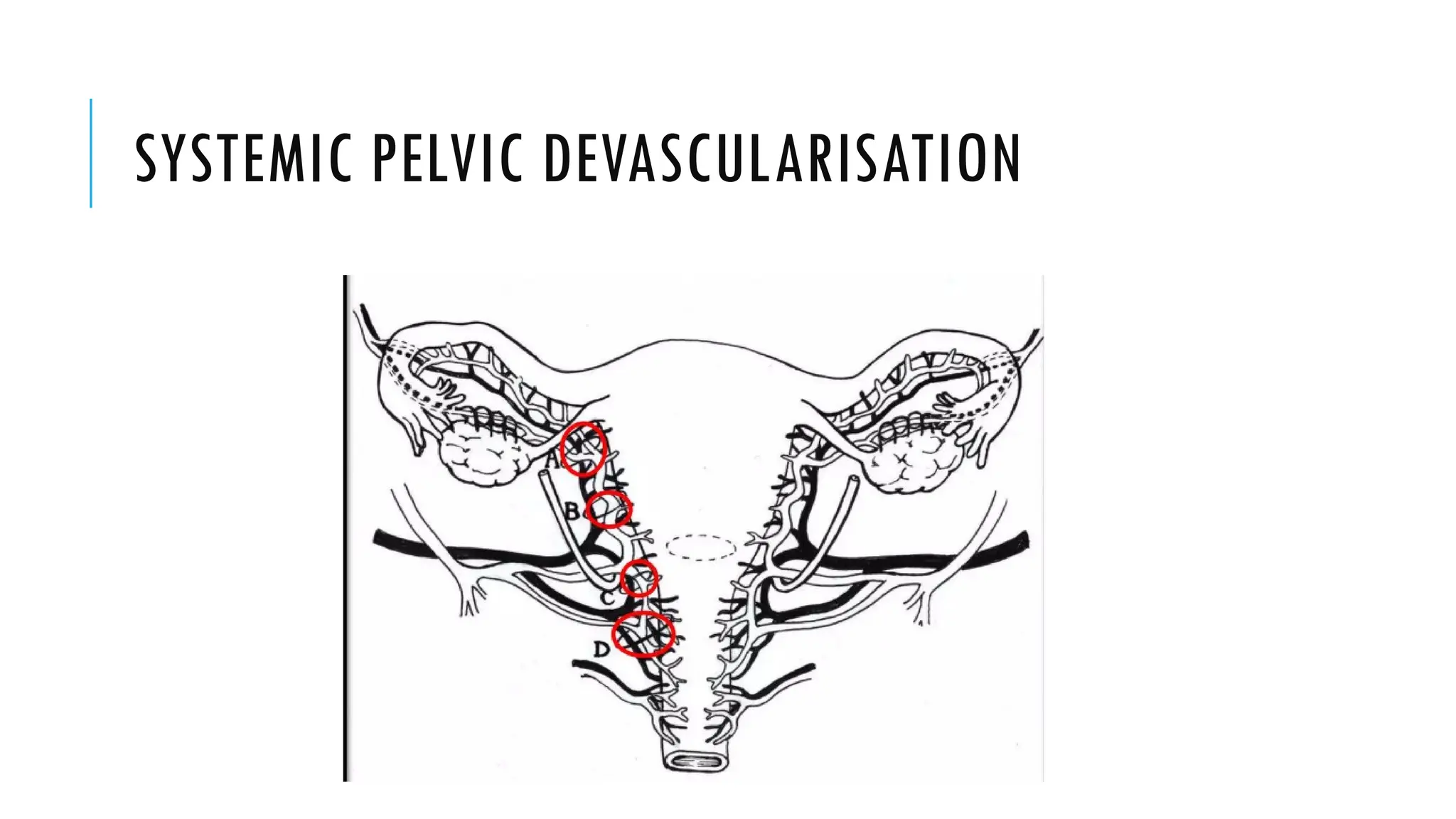 Blood supply of female genital tract edited.pptx