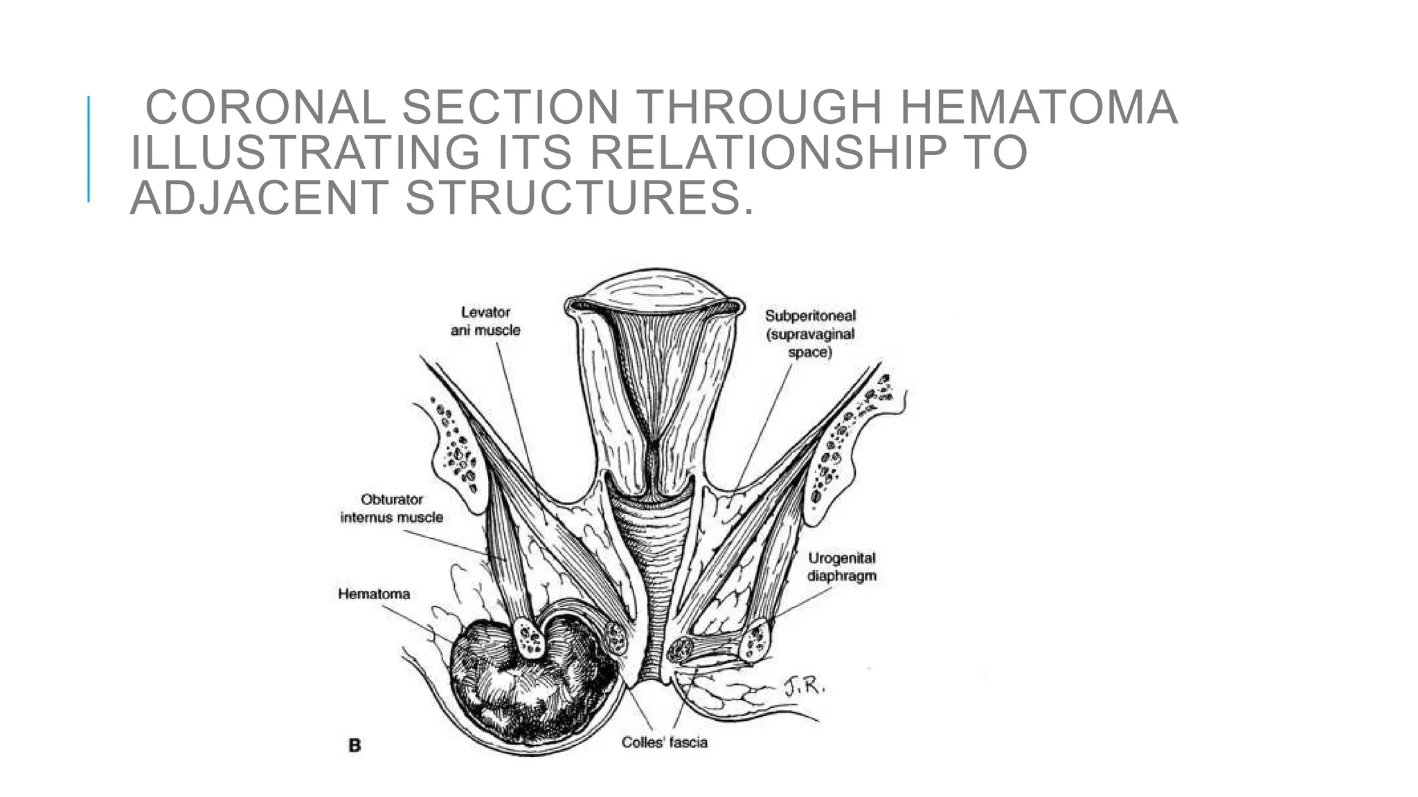 Blood supply of female genital tract edited.pptx