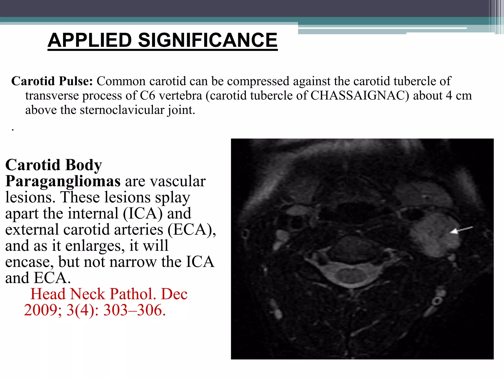 Arteries of Head and Neck | PPTX