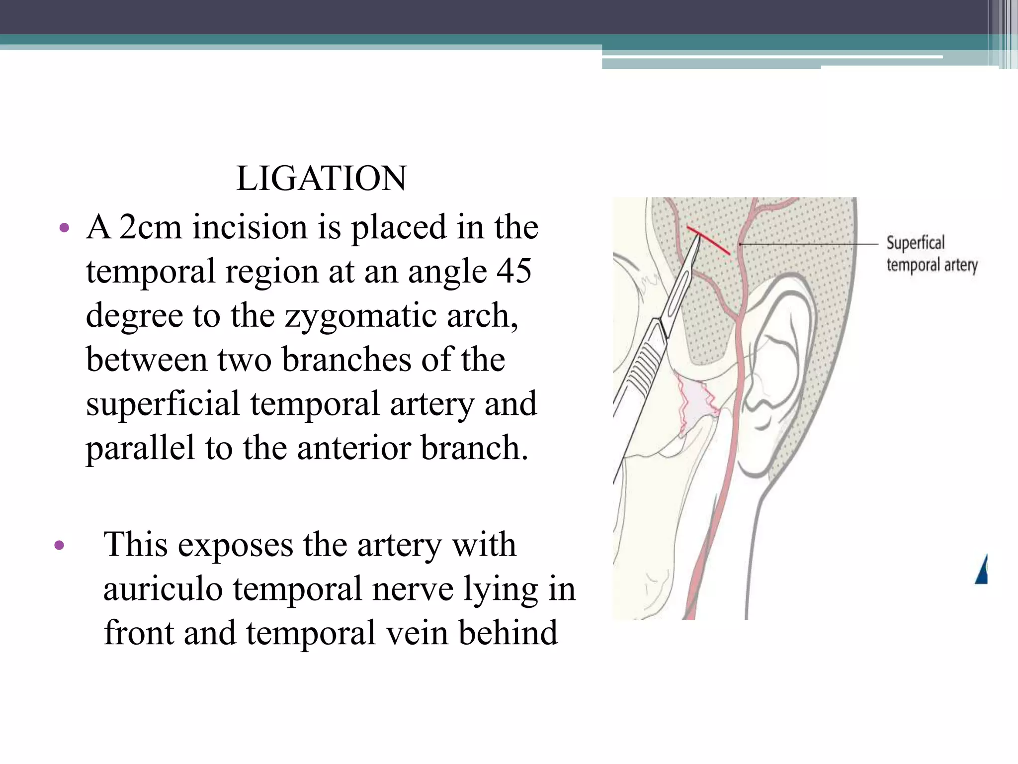 Arteries of Head and Neck | PPTX
