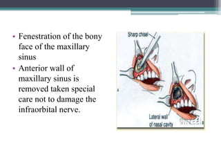 Arteries of Head and Neck | PPTX