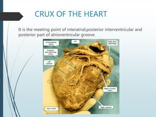 Blood supply of heart | PPT