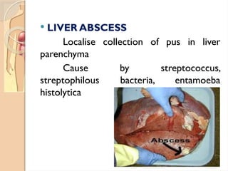 BLOOD SUPPLY OF LIVER can be used to take lecture | PPTX