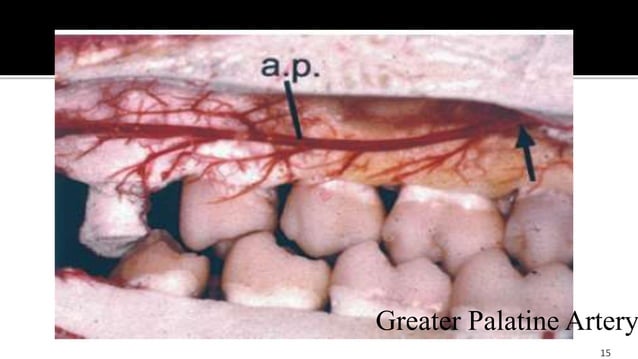 Blood supply of periodontium | PPTX | Dental Health | Diseases and ...