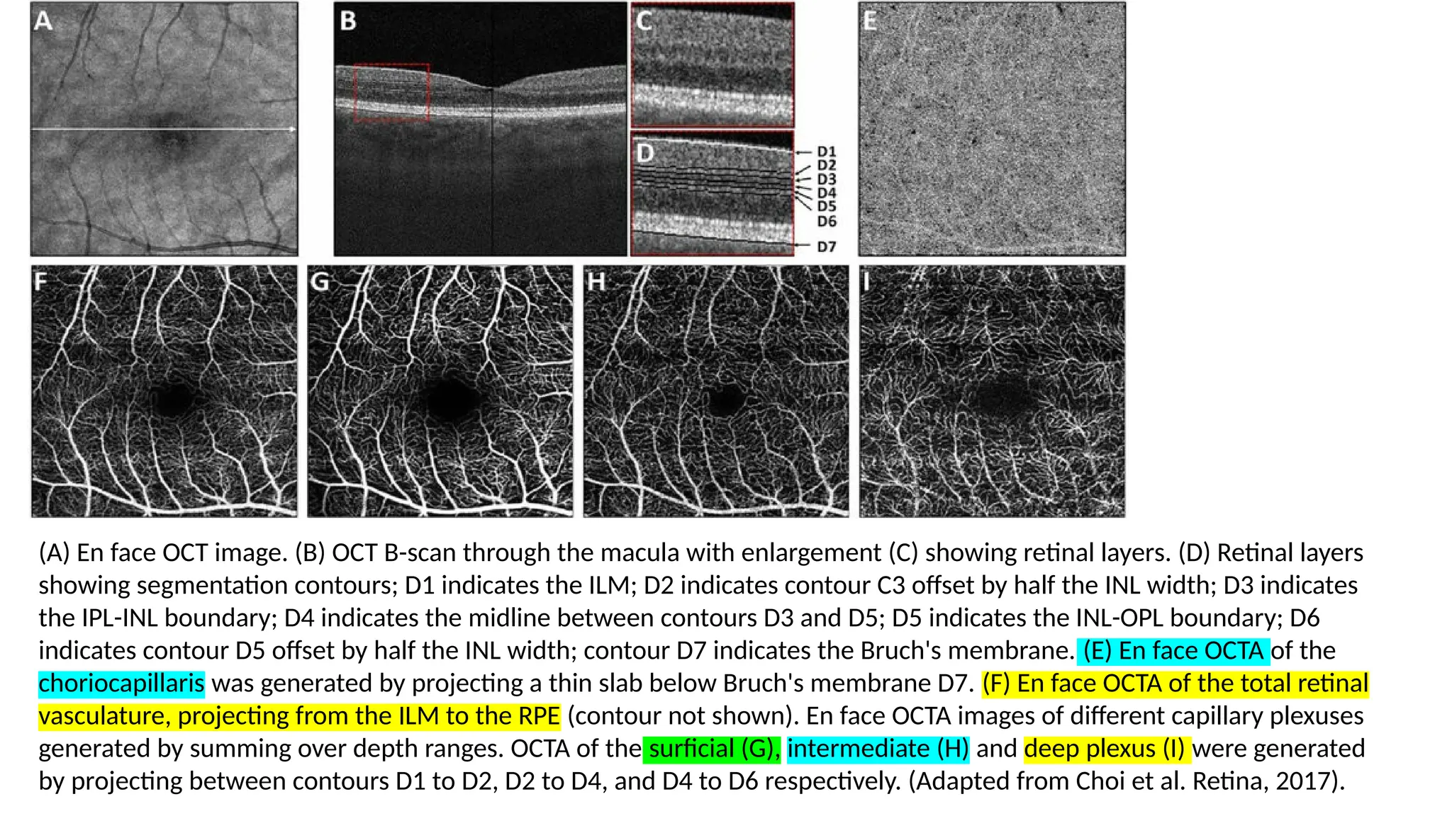 Blood supply of retina, optic nerve head | PPTX