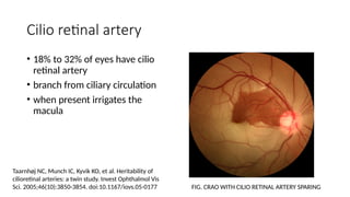 Blood supply of retina, optic nerve head | PPTX
