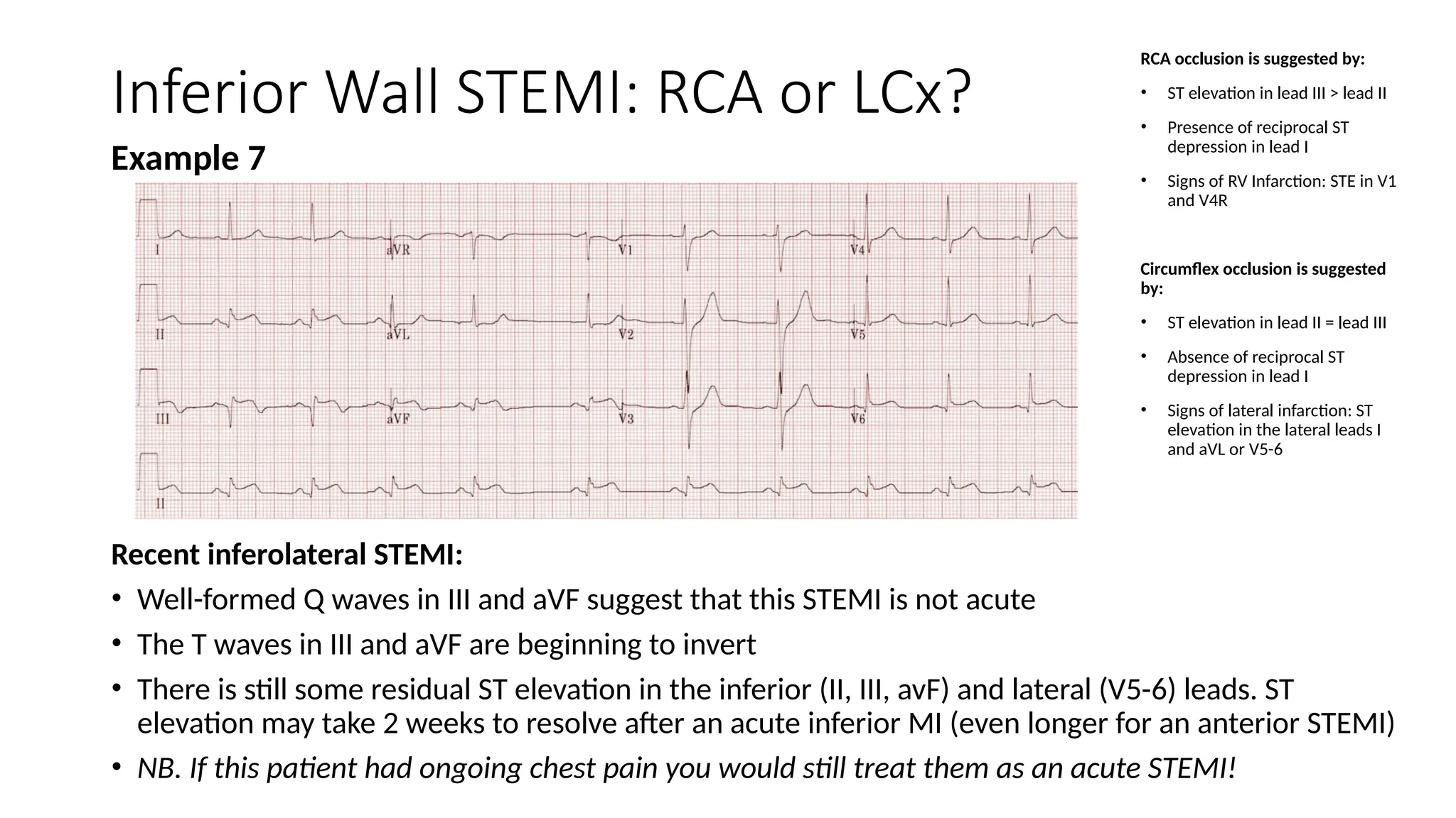 Blood Supply of SA and AV Nodes and Inferior Wall MI.pptx