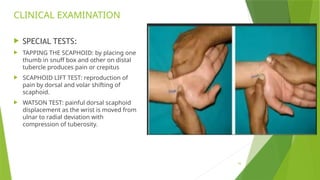 Blood supply of scaphoid and scaphoid fractures.pptx