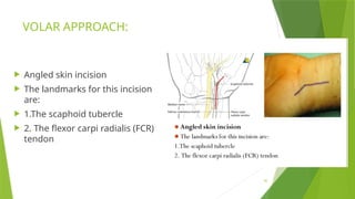 Blood supply of scaphoid and scaphoid fractures.pptx