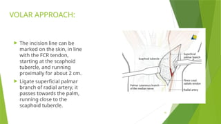 Blood supply of scaphoid and scaphoid fractures.pptx