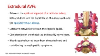 Blood supply of spinal cord | PPTX