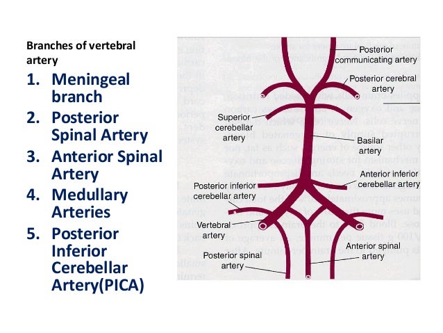 Paramedian Branch Of Anterior Spinal Artery A Schematic Presentation