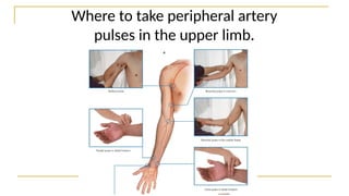 blood supply of upper limb and its clinical anatomy | PPTX