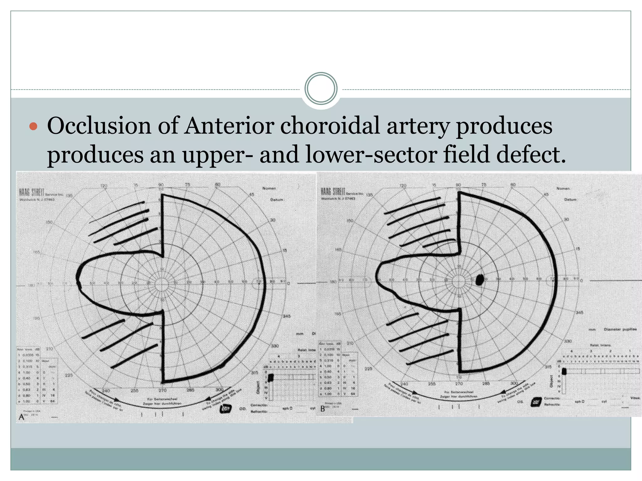 BLOOD SUPPLY OF VISUAL PATHWAY | PPTX