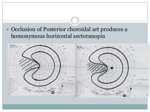 BLOOD SUPPLY OF VISUAL PATHWAY