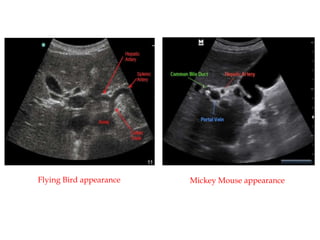 Blood supply of the liver | PPTX