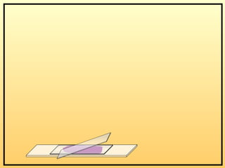 Blood test | PPT