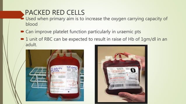 Blood transfusion - components , procedure , pre transfusion testing ...