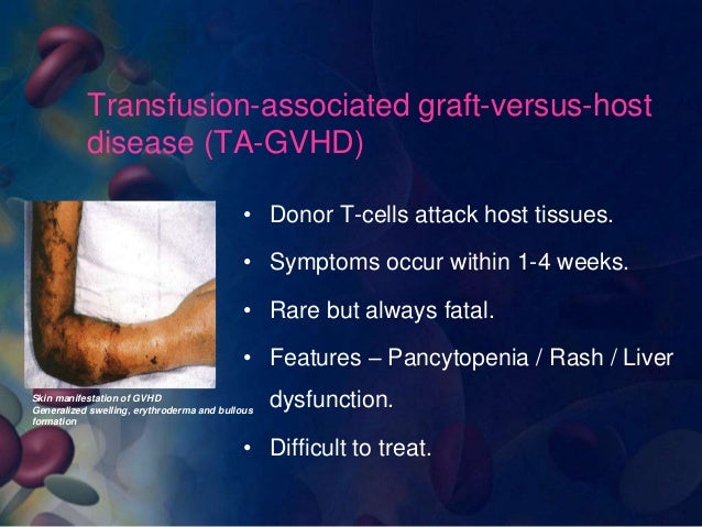 Blood transfusion