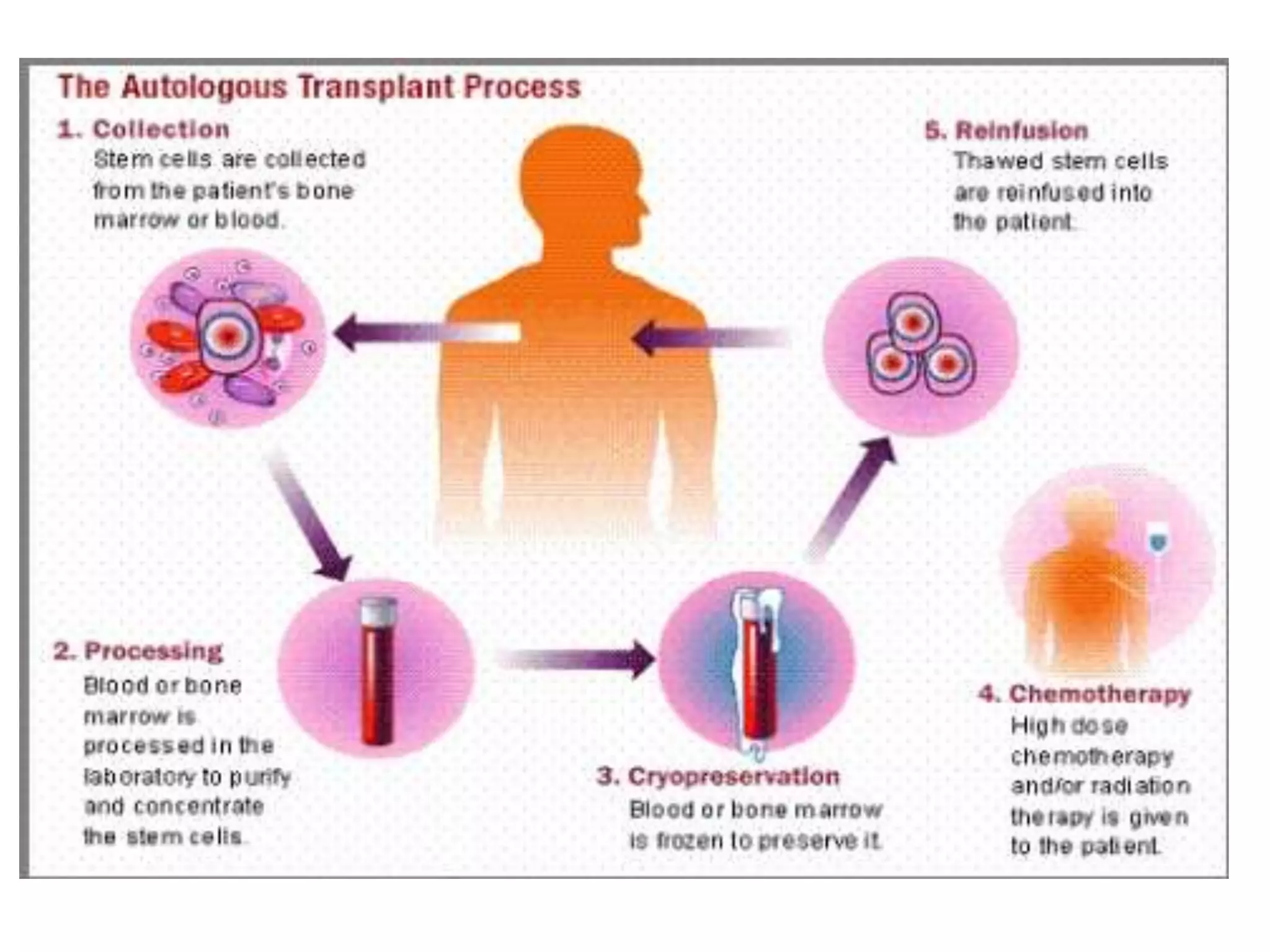 Blood Transfusion - Final work.pptx