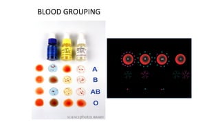 Blood transfusion and transfusion reactions | PPT