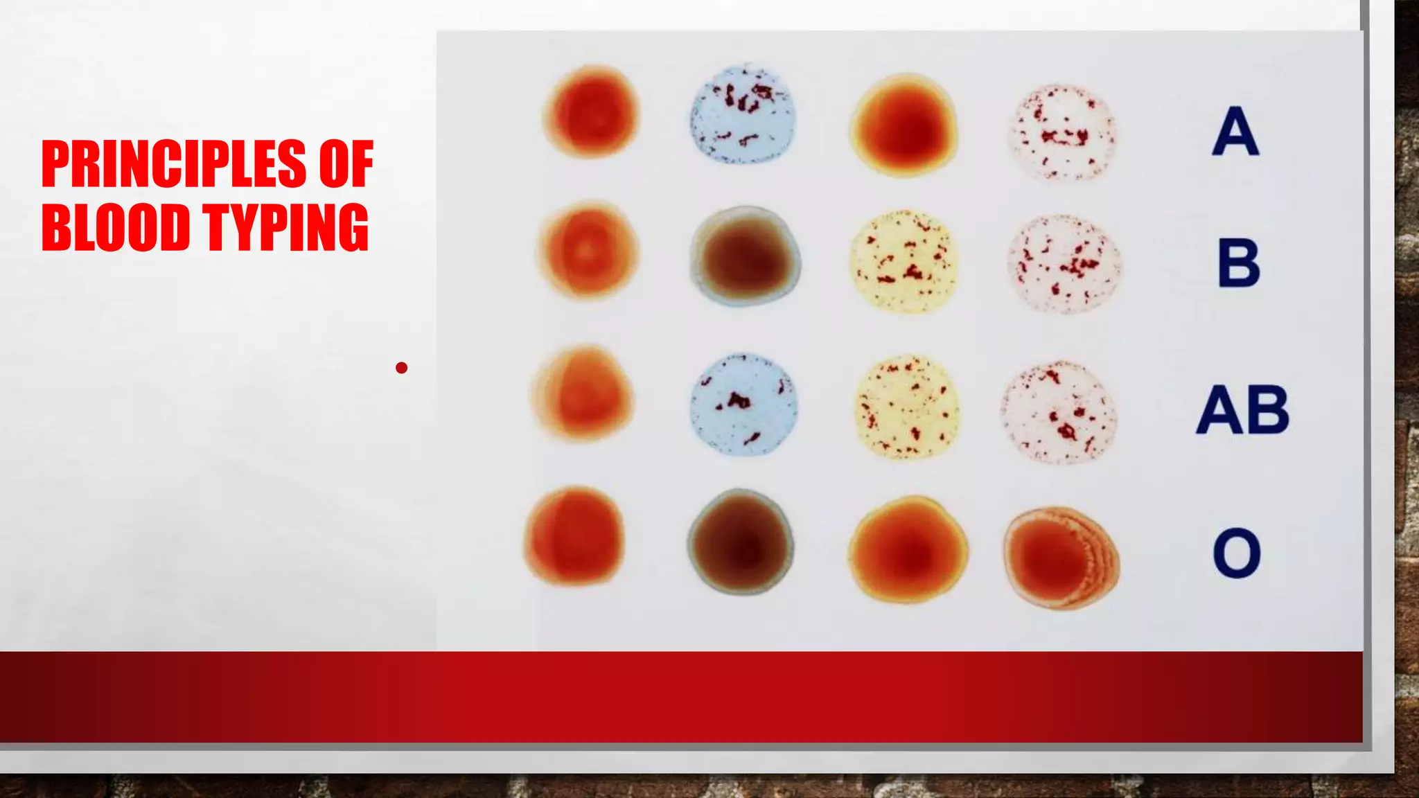 Blood transfusion in oral and maxillofacial surgery | PPTX