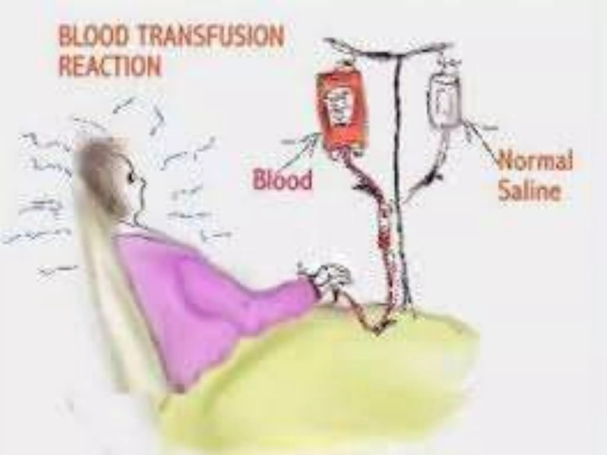 Blood transfusion reaction | PPTX