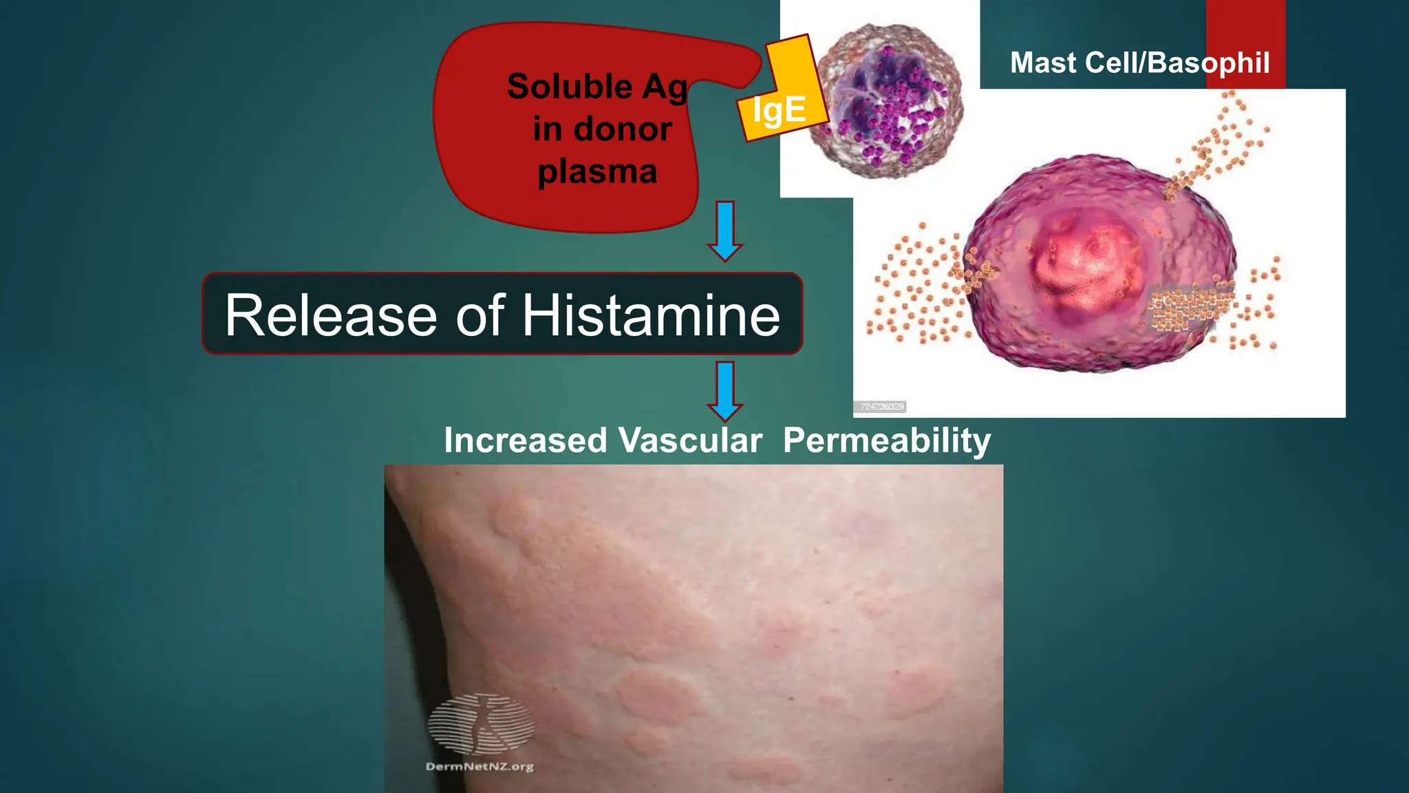 Blood transfusion Reactions Path - SLIDE SHARE.pptx