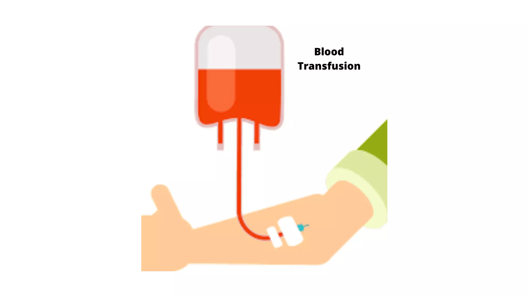 Blood transfusion Therapy - BT | PDF