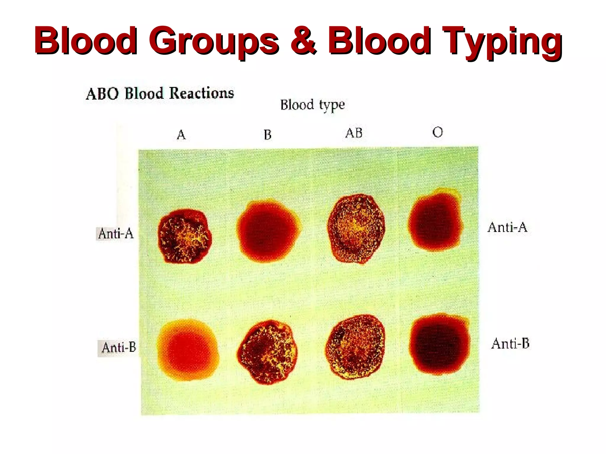 Blood Typing | PPT
