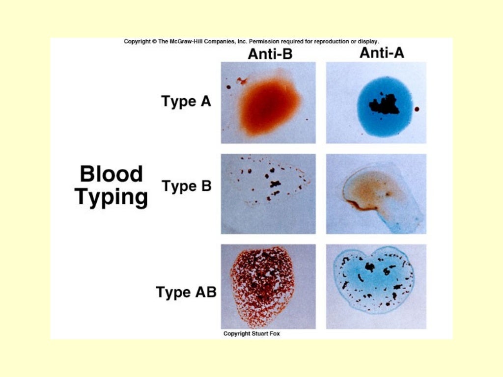 Blood Typing