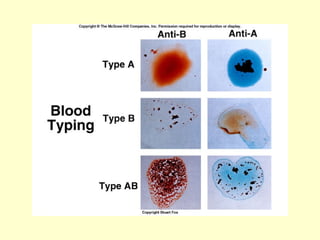 Blood typing ppt | PPT