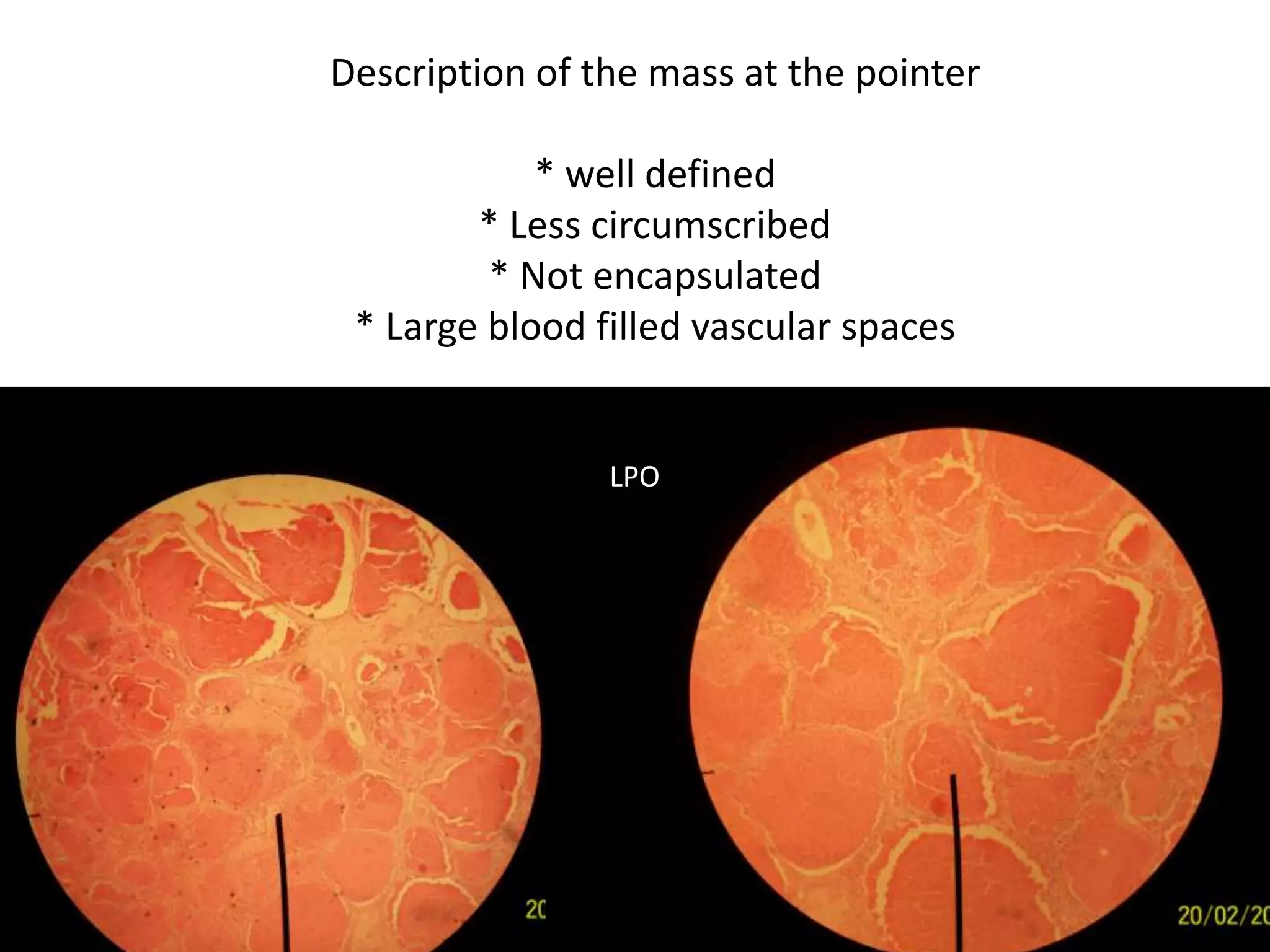 Blood Vessel Diseases | PPTX | Heart and Cardiovascular Diseases ...