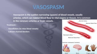 BLOOD VESSEL DISORDERS AND TYPES AND THEIR TREATMENTS | PPT