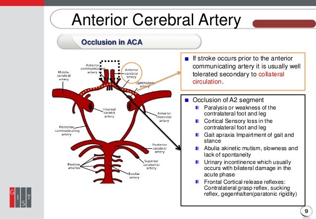 Blood vessels of brain (2)