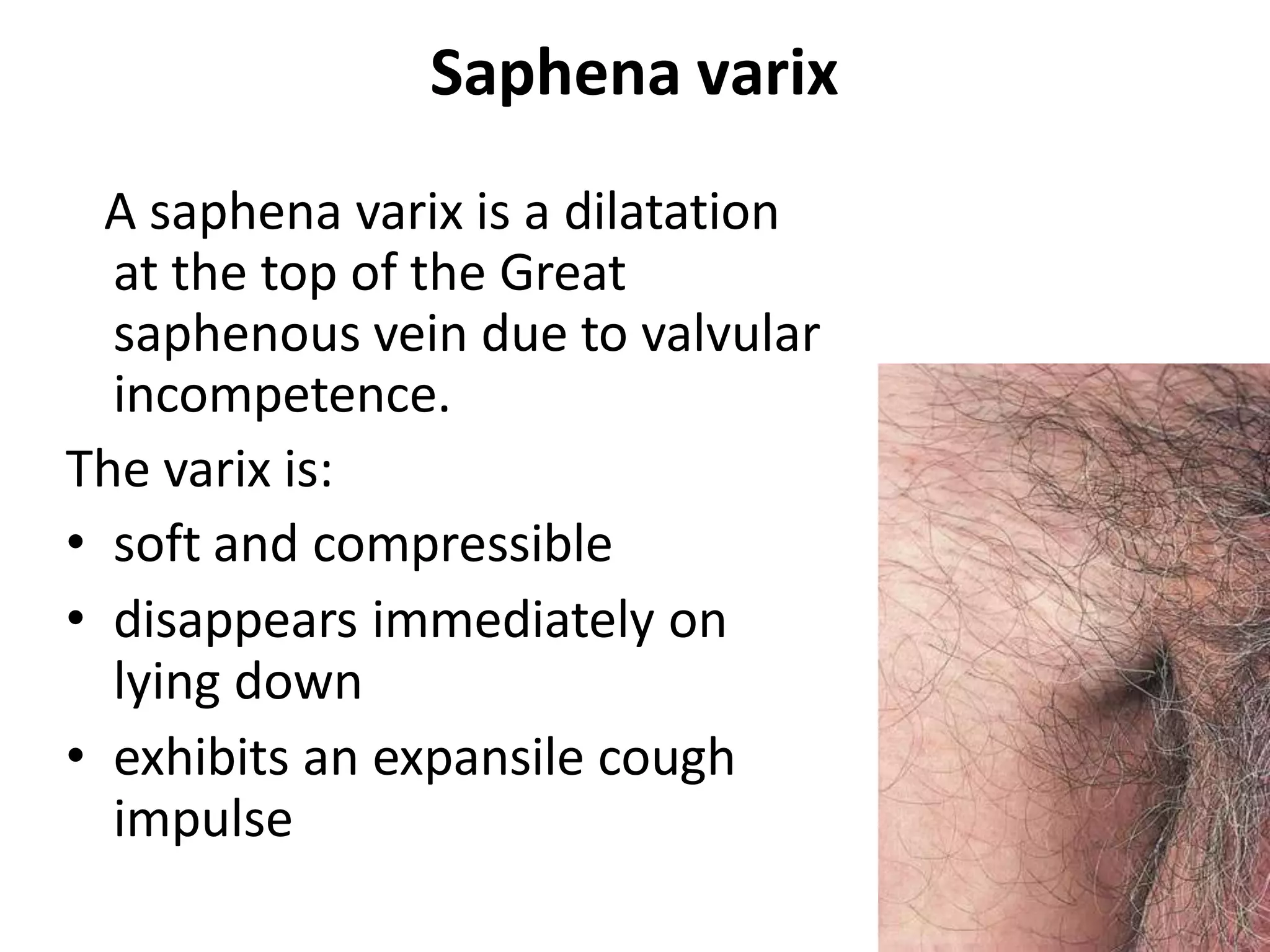 Blood Vessels of Lower Limb.pptx