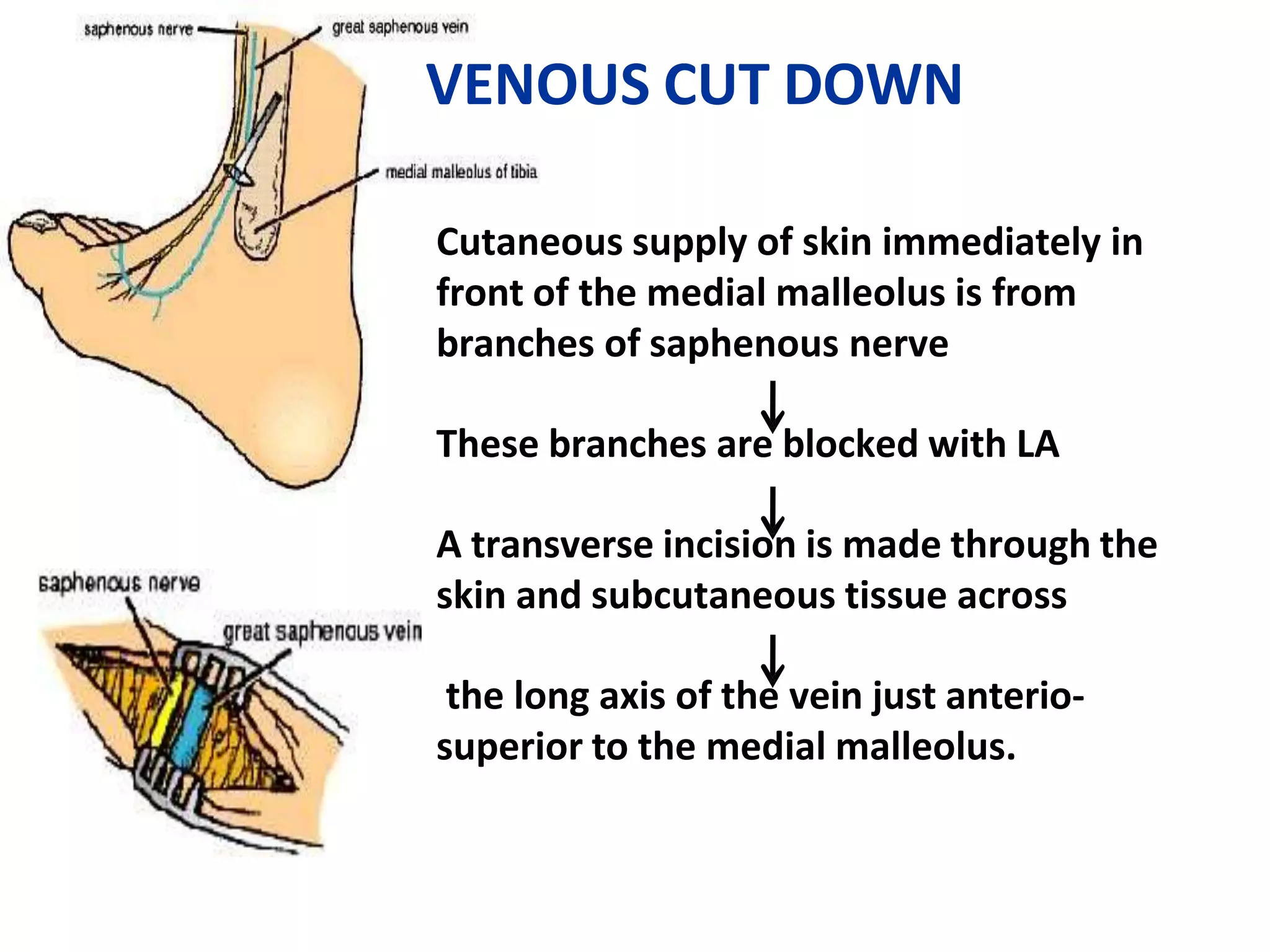 Blood Vessels of Lower Limb.pptx