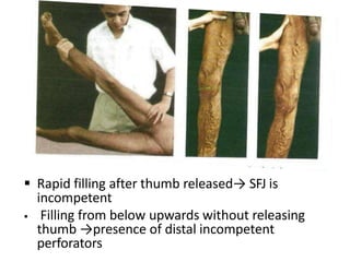 Blood Vessels of Lower Limb.pptx