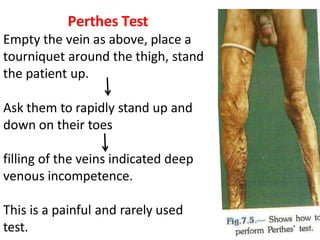 Blood Vessels of Lower Limb.pptx