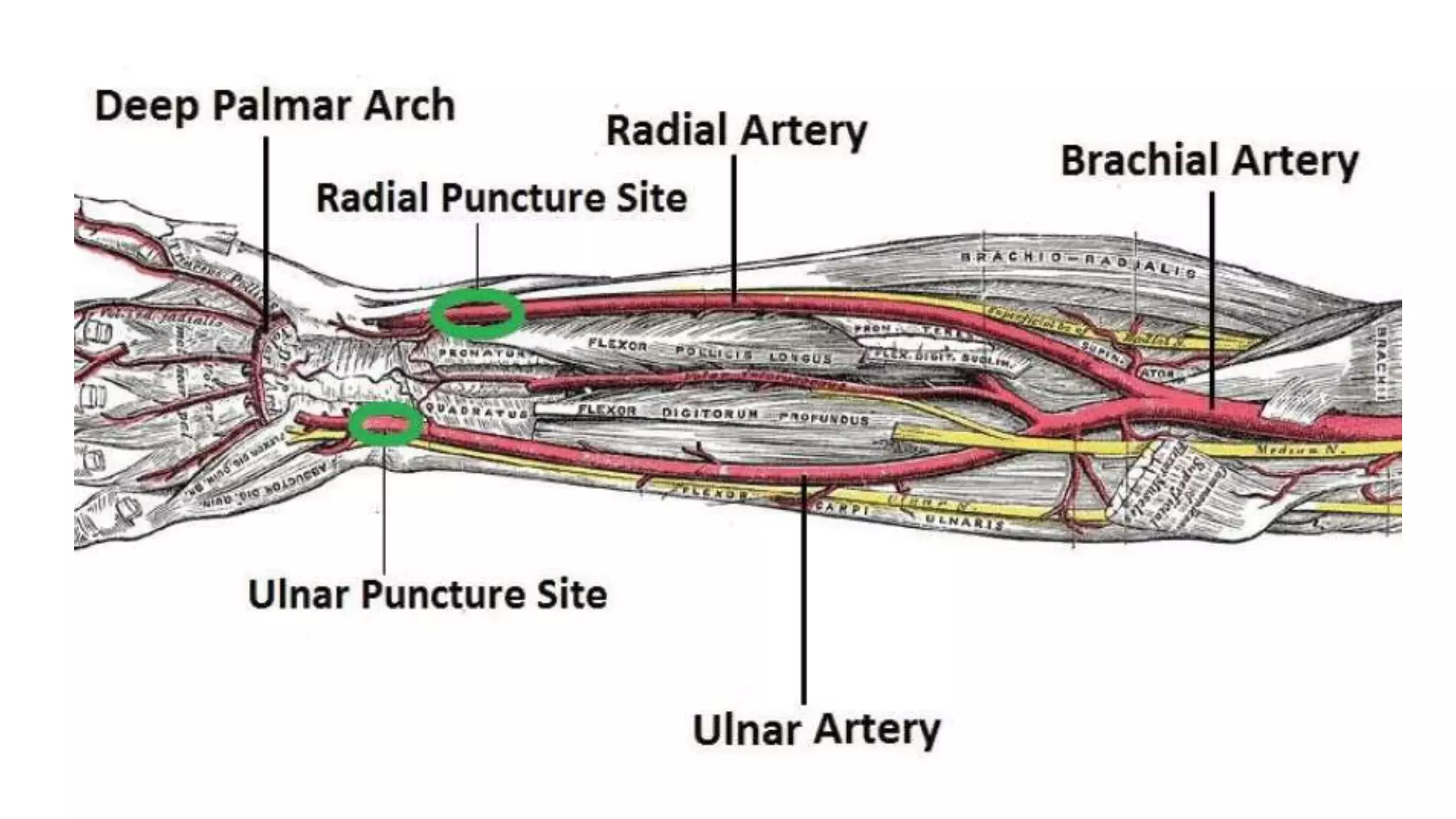 Blood vessels of Upper Limb.pptx