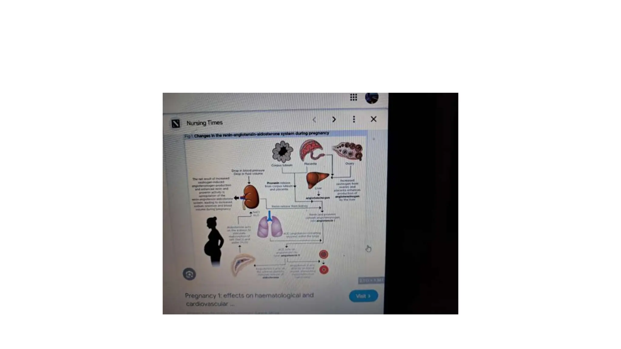 Blood volume_ normal balues_hypervolemia.pptx